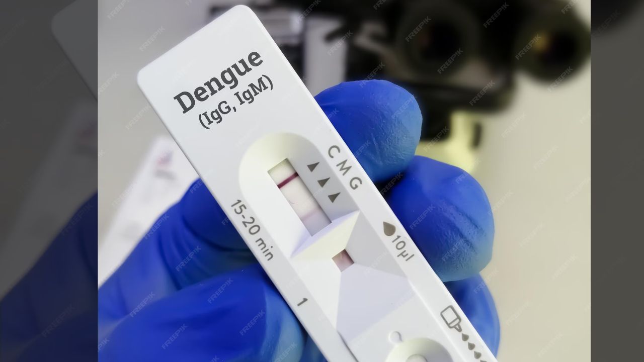 Salud Pública afirma que prueba de PCR agiliza diagnóstico del dengue ...